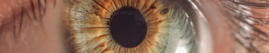 Eye Conditions Explained by Visioncare Direct - Wolverhampton Opticians